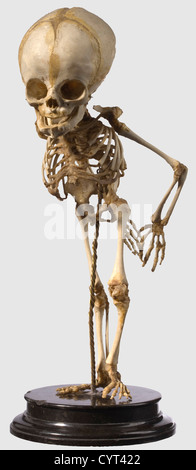 A German skeleton prepared for pathological or anatomical studies,19th ...