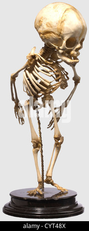 A German skeleton prepared for pathological or anatomical studies,19th ...