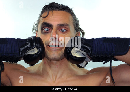 Funny boxer man with black eye on white background Stock Photo - Alamy