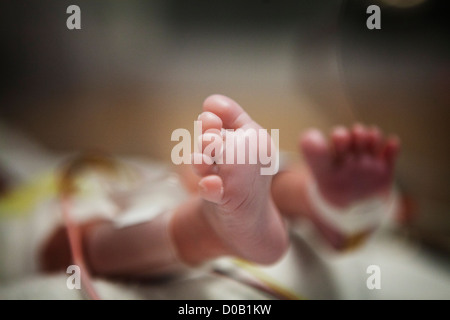 FOOT OF PREMATURE BABY Stock Photo: 49257893 - Alamy