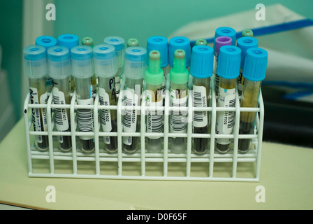 Prothrombin Time - Test with blood sample. Top view isolated on office ...