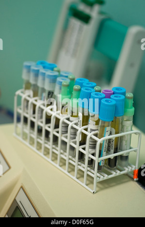 Prothrombin time test tubes Stock Photo - Alamy