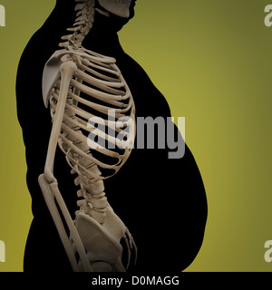 Skeleton of overweight man layered over his silhouette of body fat ...