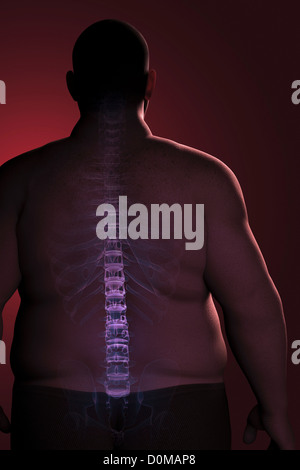 Skeletal structure of the spine layered over overweight man's body to ...