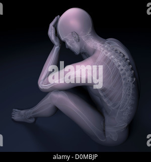 Anatomical model showing the skeletal alignment of a human bent over ...