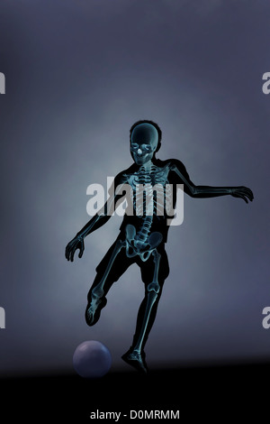A pre-adolescent male child kicks soccer ball. bones are visible within ...