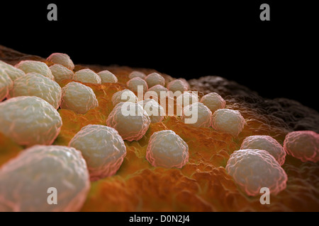 Rubella virus particles on cellular surface. Rubella disease commonly ...