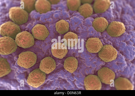 Rubella virus particles on cellular surface. Rubella disease commonly ...