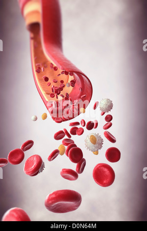A section of a blood vessel with blood cells rushing towards the ...