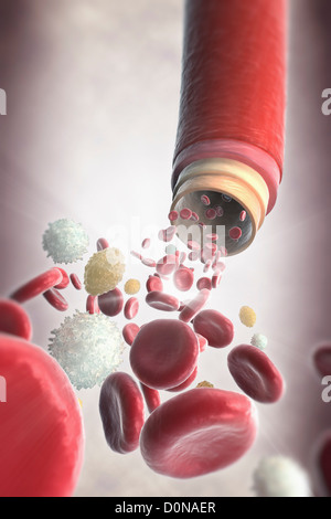 A section of a blood vessel with blood cells rushing towards the ...