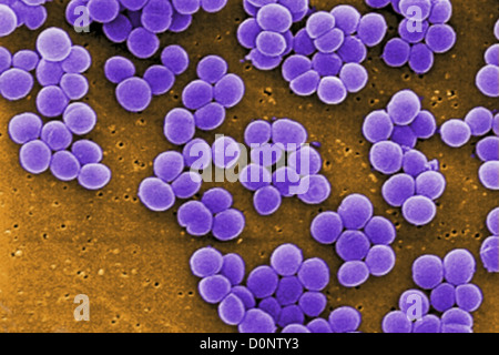 Under high magnification of 10,000x, this scanning electron micrograph ...