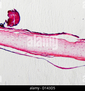 science micrograph of bone cell osteocyte Stock Photo - Alamy