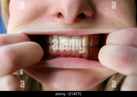 mouth teeth gums rictus grin Stock Photo - Alamy