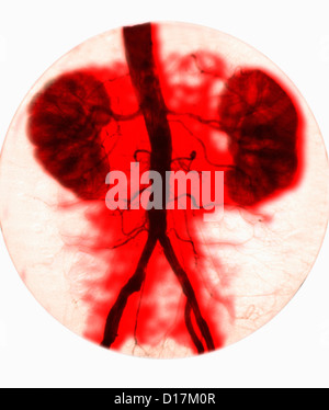 X-ray of Normal Kidneys Stock Photo - Alamy