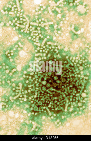 Hepatitis-B Virus, EM Stock Photo - Alamy