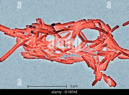 Legionella bacteria. Coloured scanning electron micrograph (SEM) of ...