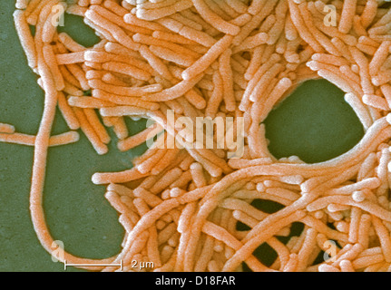 Legionella bacteria. Coloured scanning electron micrograph (SEM) of ...