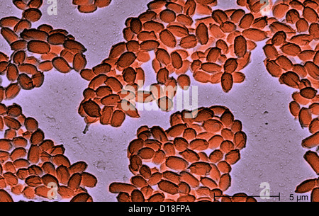 Electron micrograph of spores of Bacillus anthracis, a Gram-positive ...