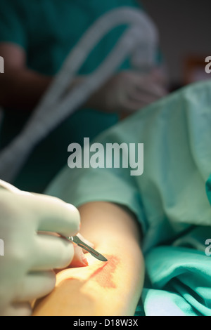 Doctor performing surgery on an arm Stock Photo - Alamy