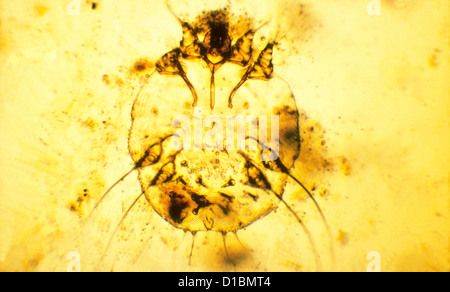 A photomicrograph of a sarcoptes scabiei mite, a parasitic arthropod ...