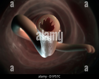 Hookworm head. Computer illustration of the head of the parasitic ...