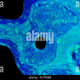 Compact bone, light micrograph Stock Photo - Alamy
