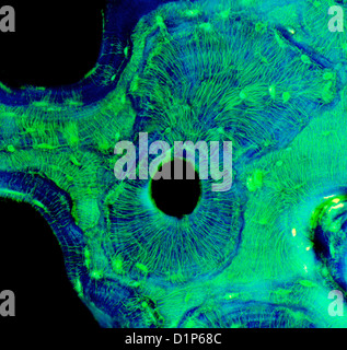Compact bone, light micrograph Stock Photo - Alamy