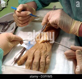 (dpa) - Renowned hand surgeons practice the newest plastic surgery ...