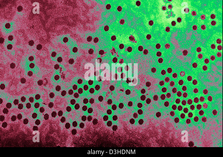 Electron micrograph of parvovirus H-1 virions of the Parvoviridae Stock ...