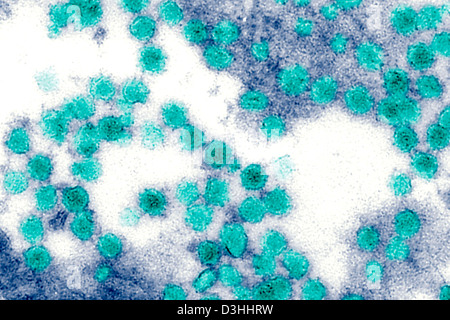 west nile virus electron microscopy EM TEM color colour enhanced Stock ...