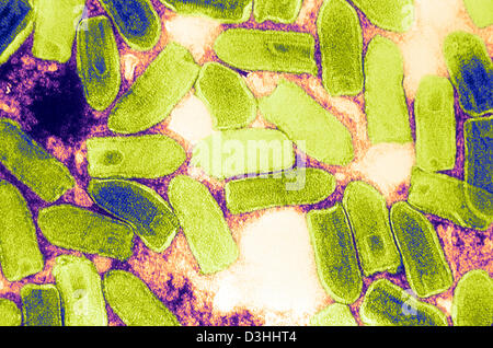 Vesicular Stomatitis Virus, TEM Stock Photo - Alamy