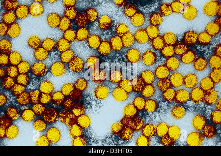 Yellow Fever Virus, TEM Stock Photo - Alamy