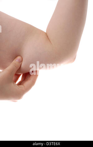 fat woman, woman hand pinching on her excessive fat arm with measure ...