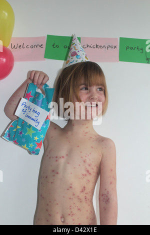 Girl having a chickenpox party Stock Photo - Alamy