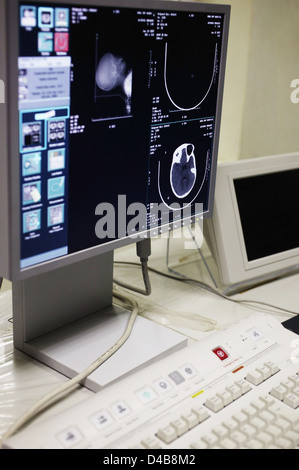 Control panel and control screen of a Computed Tomography (CT) scan ...