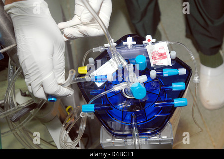 Venous reservoir part Cardiopulmonary bypass (CPB) also known as Heart ...