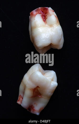 Two clean extracted wisdom teeth, not fully developed Stock Photo - Alamy