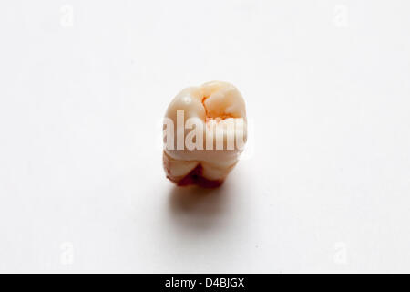 A clean extracted wisdom tooth, not fully developed Stock Photo - Alamy