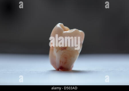A clean extracted wisdom tooth, not fully developed Stock Photo - Alamy