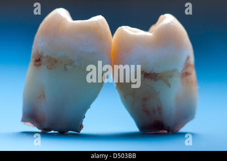 Clean extracted wisdom teeth, not fully developed Stock Photo - Alamy