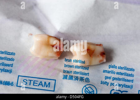 Two clean extracted wisdom teeth, not fully developed Stock Photo - Alamy