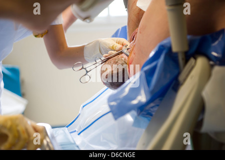 Baby being born at the moment of birth Stock Photo - Alamy