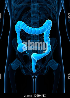 Colonic spasm, artwork Stock Photo - Alamy