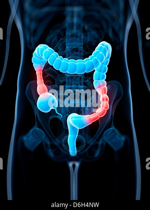 Colonic spasm, artwork Stock Photo - Alamy