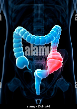 Constipated Colon, Illustration Stock Photo - Alamy