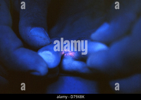 Corynebacterium minutissimum Bacteria Stock Photo - Alamy