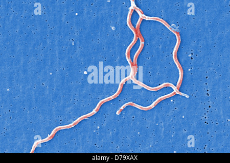 Scanning electron micrograph of Borrelia burgdorferi spirochete ...