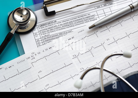 Cardiogram chart with medical stethoscope on table closeup Stock Photo ...