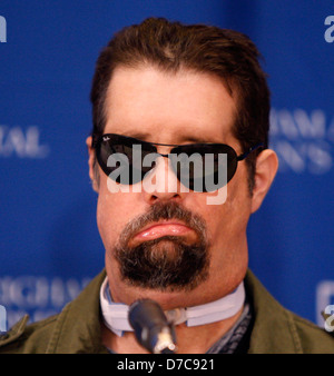 Dallas Wiens face transplant recipient, of Fort Worth, Texas, at a news ...