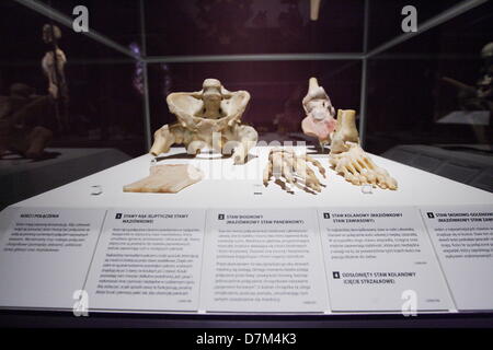 Gdansk, Poland. 10th, May 2013 The Human Body Exhibition in Gdansk. The ...